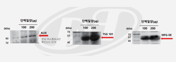 주름 개선·미백·탈모 방지까지 팔방미인 ‘초유 엑소좀’