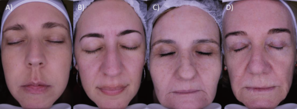 AI 업고 진화하는 피부 노화 예측·화장품 효능 연구