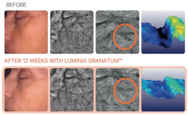 맑고 투명한 유리알 피부 광채를 위한 풋석류 스템셀 액티브 ‘Luminia Granatum™’
